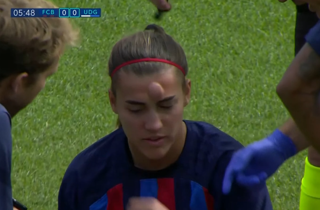 DUMPERT - Voetbalster met horrorbult