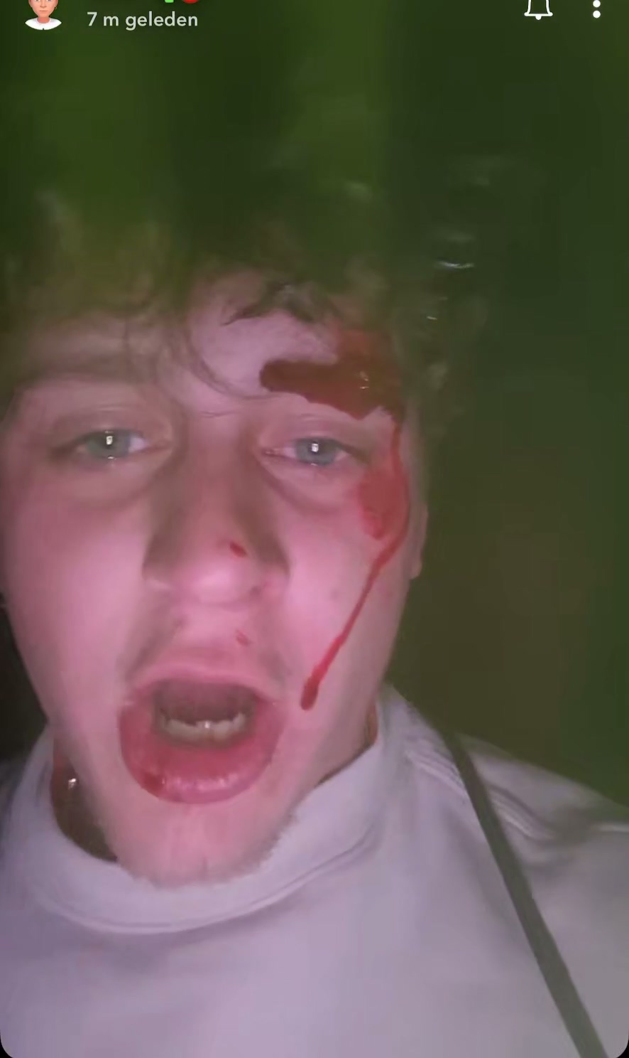 DUMPERT - Hert gebotst met de scootah