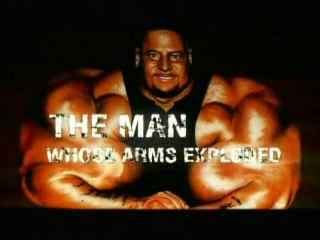 dumpert.nl - The Man Whose arms exploded