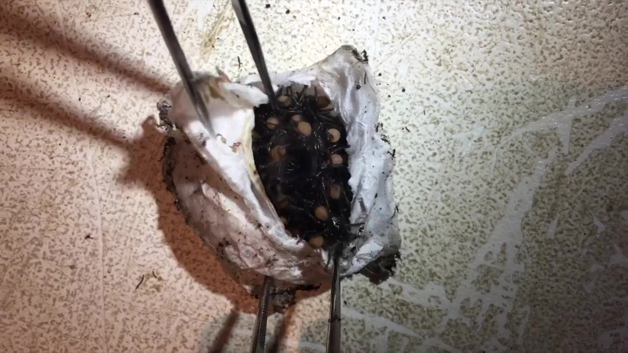 DUMPERT - Zo ziet teelbalkanker eruit