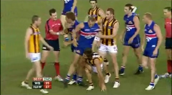 dumpert.nl - Jordan Lewis gaat de binnenkant van zijn ogen bekijken