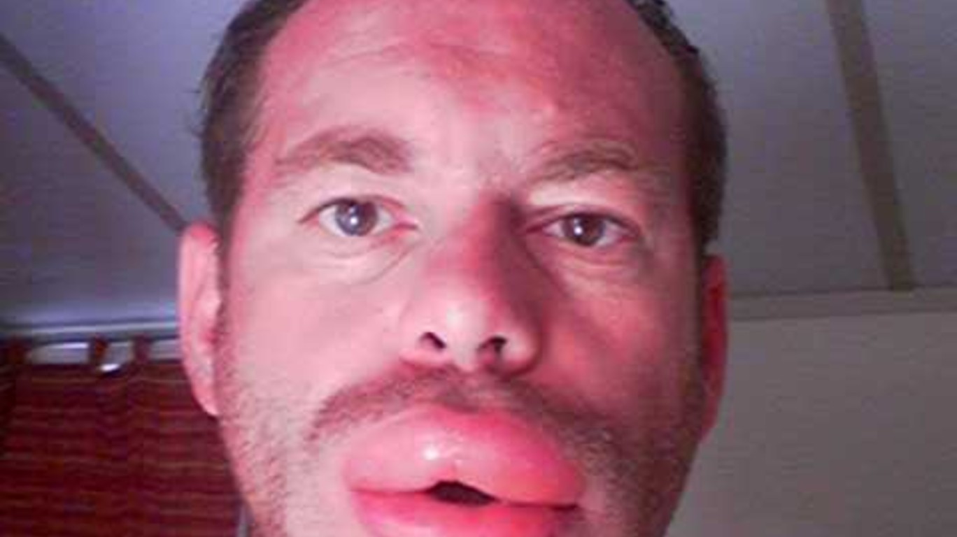 DUMPERT - blanke neger in spee